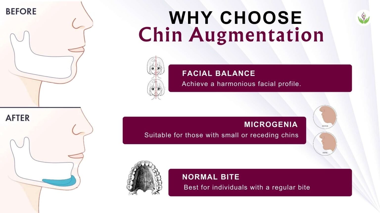 Chin Augmentation in Delhi - Cost, Implants & Results | Care Well ...