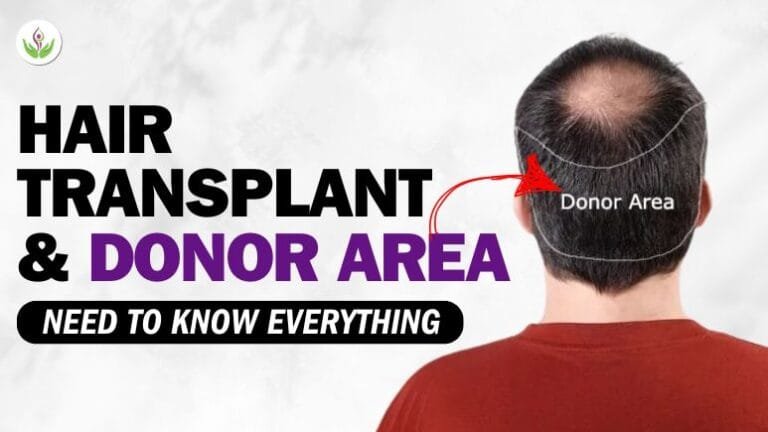 Hair Transplant Donor Area: Need to Know Everything | Care Well Medical ...
