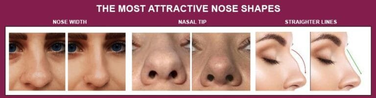 How to Change the Shape of Your Nose: Best Methods in 2025 | Care Well ...