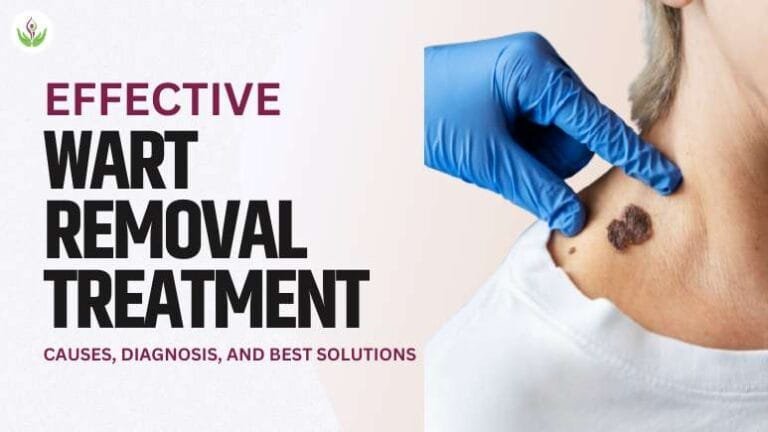 Effective Wart Removal Treatments: Causes, Diagnosis | Care Well ...