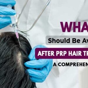 PRP Treatment for Hair: How It Works and What to Expect | Care Well ...